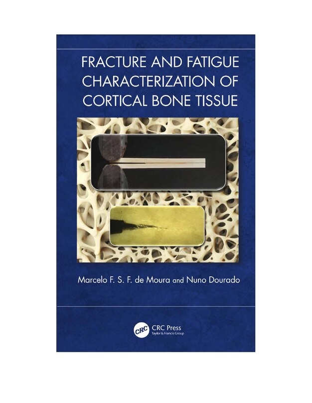Fracture and Fatigue Characterisation of Cortical Bone Tissue | Indigo