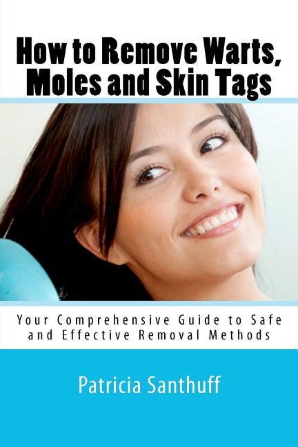 How To Remove Warts, Moles And Skin Tags: Your Comprehensive Guide To ...