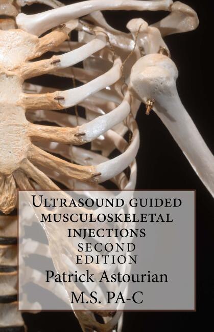 Ultrasound Guided Musculoskeletal Injections | Indigo