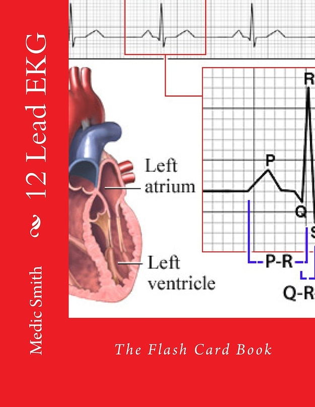 12 Lead Ekg: The Flash Card Book Livre Par Medic Smith, ('tp') | Indigo