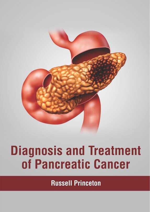 Diagnosis And Treatment Of Pancreatic Cancer ('tc') | Indigo