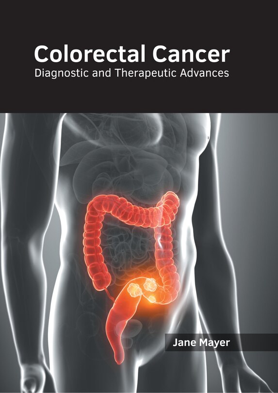 Colorectal Cancer: Diagnostic And Therapeutic Advances ('tc') | Indigo