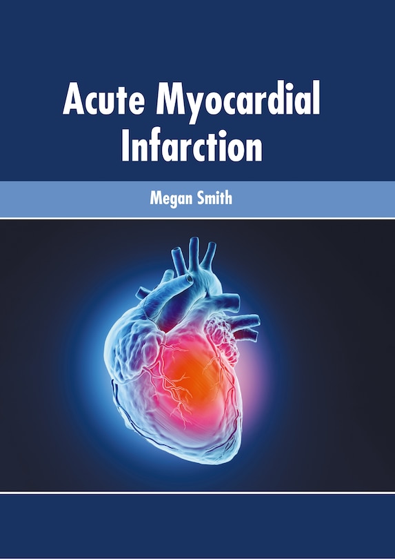 Acute Myocardial Infarction | Indigo