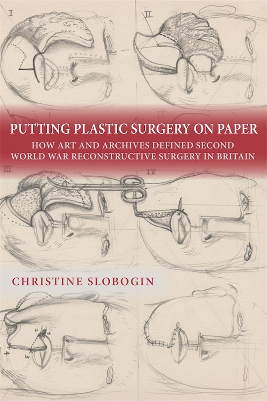 Putting Plastic Surgery On Paper: How Art And Archives Defined Second ...