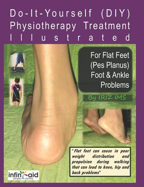 Physiotherapy Treatment Illustrated For Flat Feet (pes Planus) Foot ...