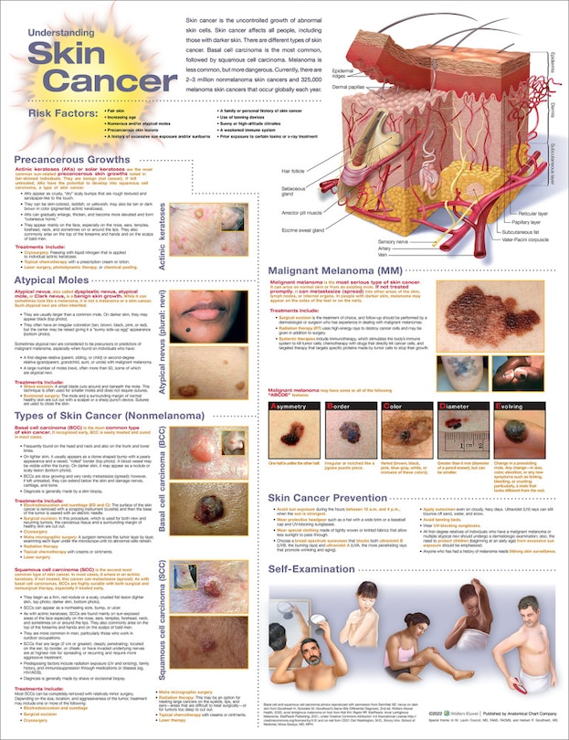 Understanding Skin Cancer Anatomical Chart Livre Par Anatomical Chart ...