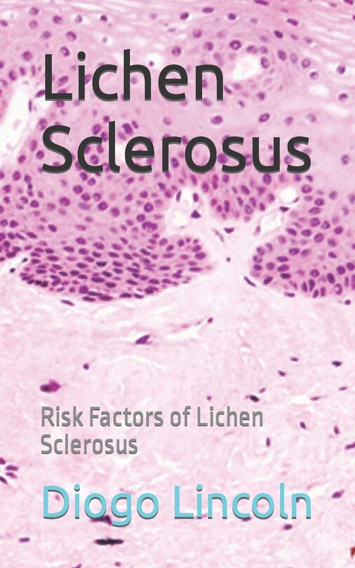 Lichen Sclerosus: Risk Factors Of Lichen Sclerosus Book By Diogo ...
