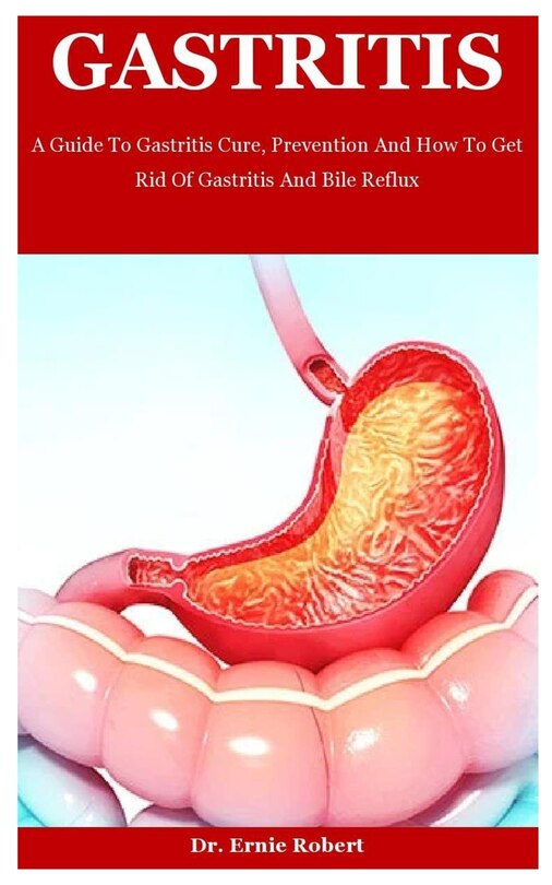 Gastritis: A Guide To Gastritis Cure, Prevention And How To Get Rid Of Gastritis And Bile Reflux ...